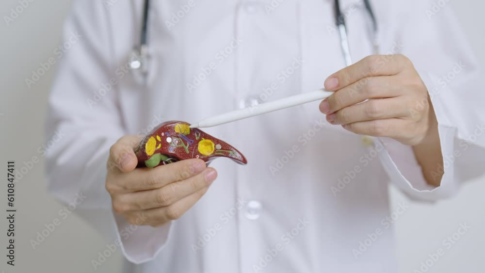 Doctor with human Liver model. Liver cancer and Tumor, Jaundice, Viral ...