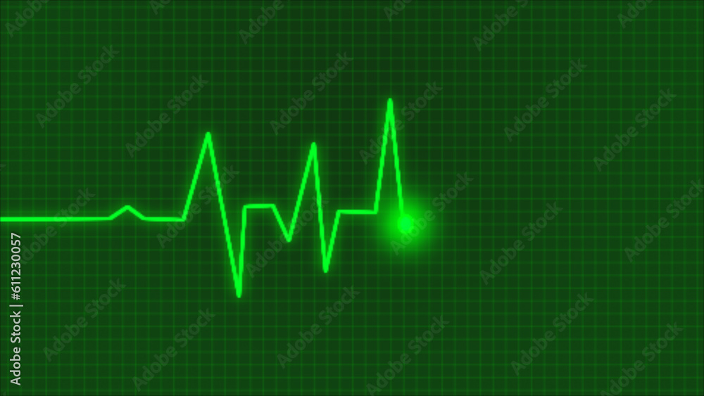 EKG monitoring in an emergency. blue neon lights a heartbeat. The ...