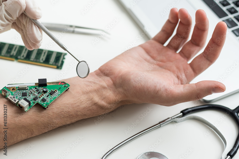 Hand with implantation of micro chip. X-Ray view close-up. Chipization ...