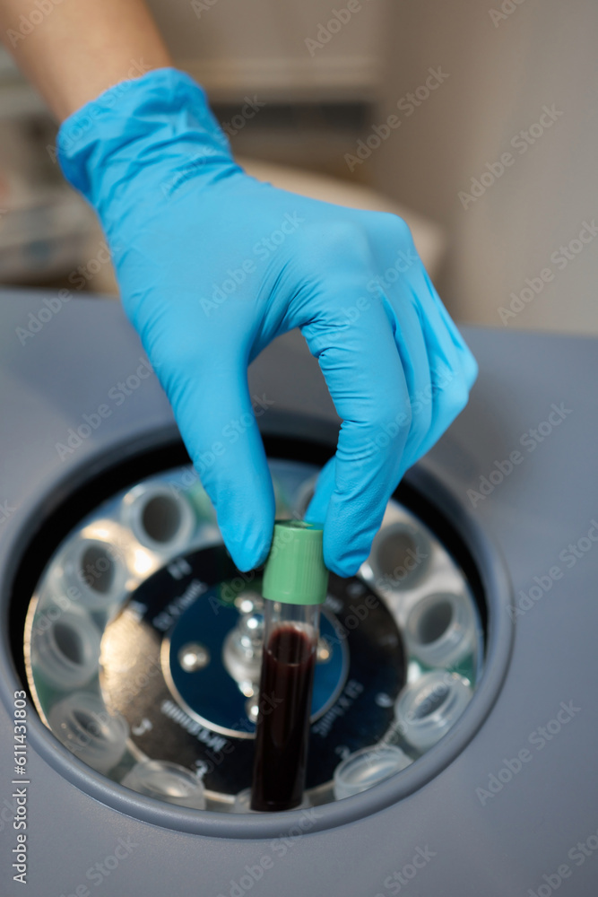 Beautician doctor's hands put test tube with blood in centrifuge ...