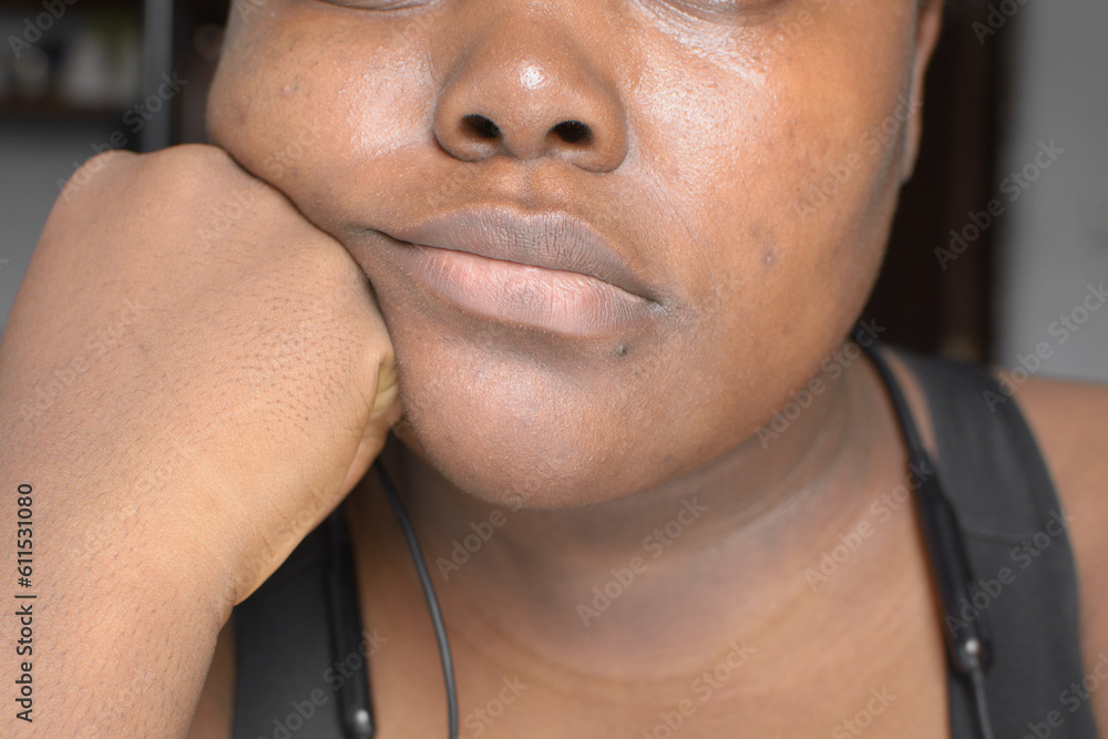 Brown skin with dark spots, hyperpigmentation on brown skin, african ...