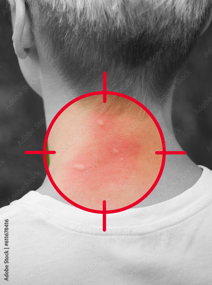 Girl with blond hair, sitting with his back turned and scratching ...