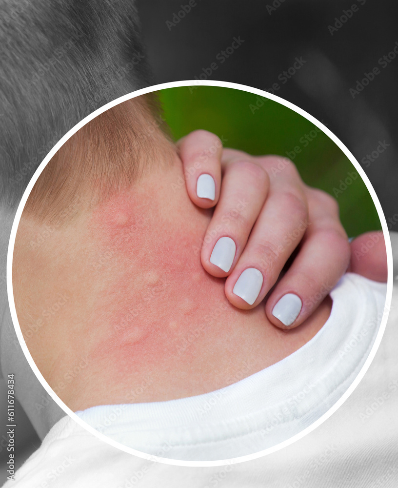 Girl with blond hair, sitting with his back turned and scratching ...