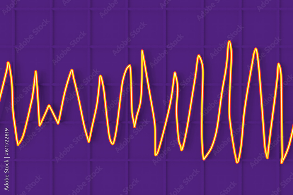 Electrocardiogram ECG displaying Torsades de pointes rhythm, 3D ...