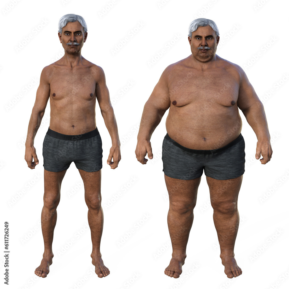 A normal weight senior Indian man and the same man in an overweight ...