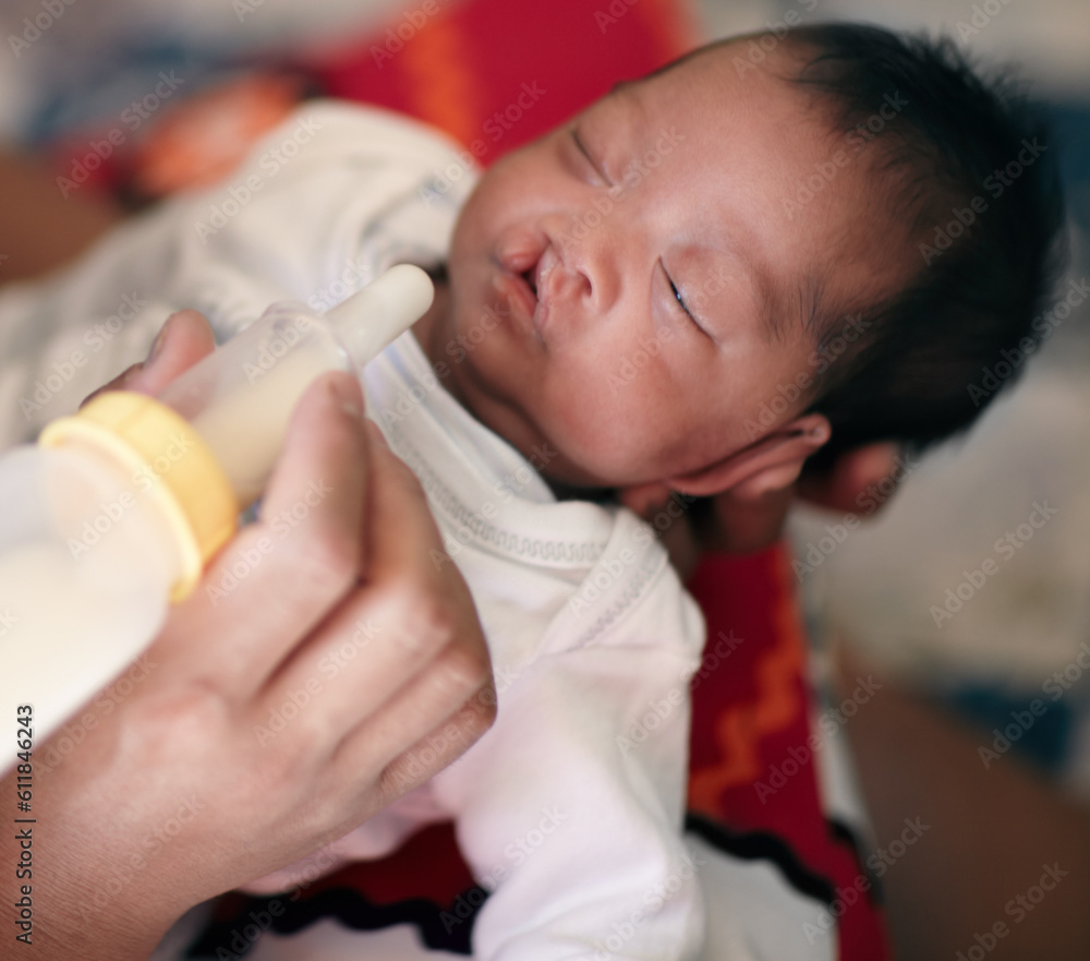 Baby with cleft lip, milk and mother feeding from bottle for nutrition ...