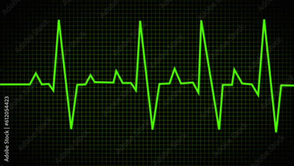 electrocardiogram, Heartbeat line, Pulse trace, ECG or EKG Cardio graph ...
