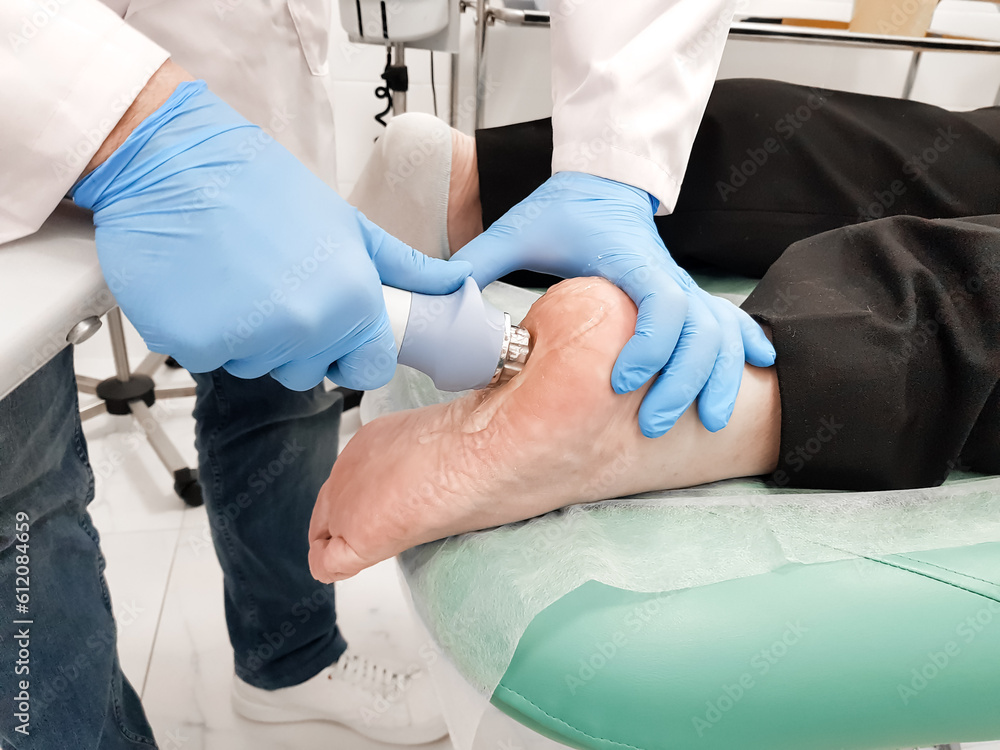 Extracorporeal shock wave therapy ESWT of heel. Visit to office of ...