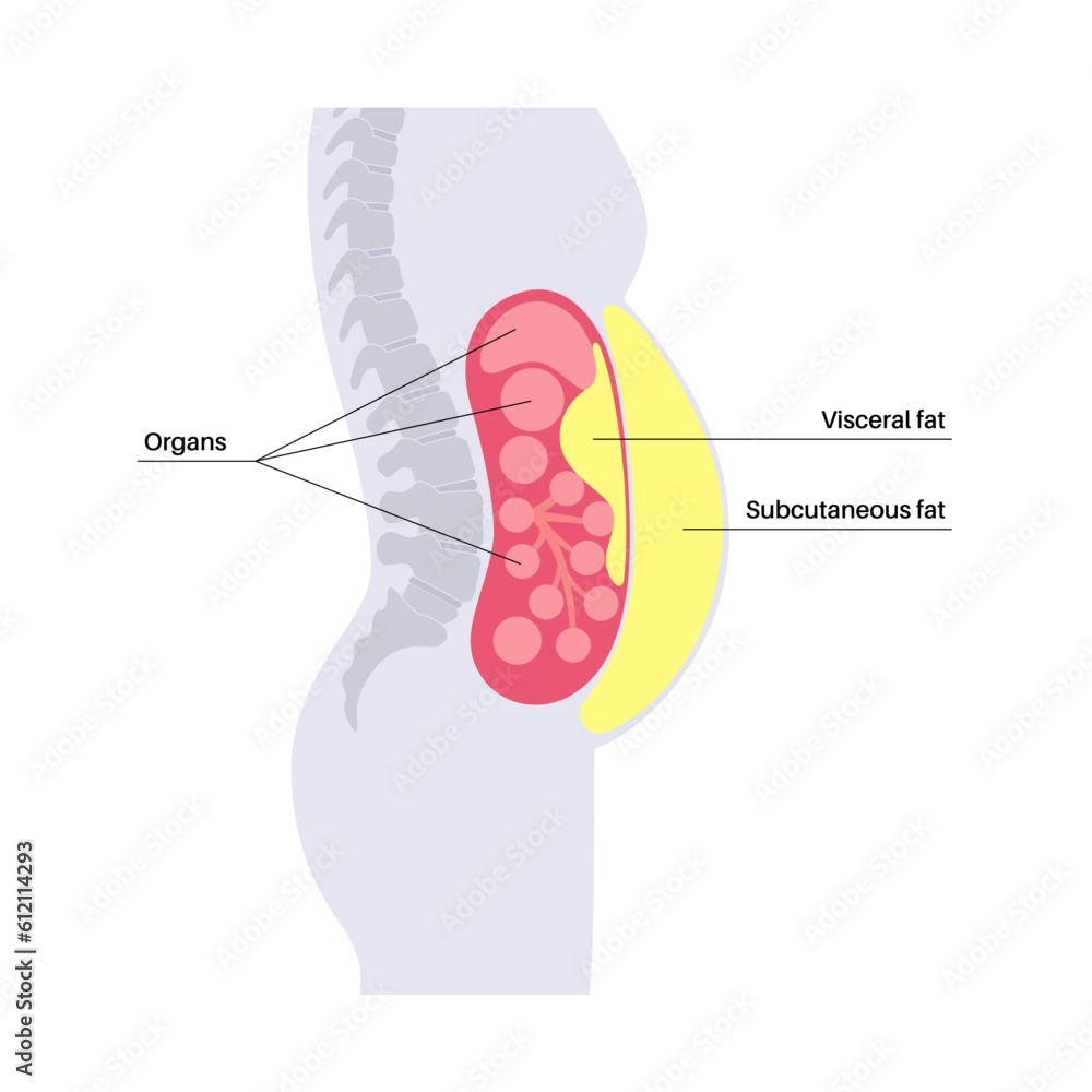 Visceral fat diagram Stock Vector | Adobe Stock