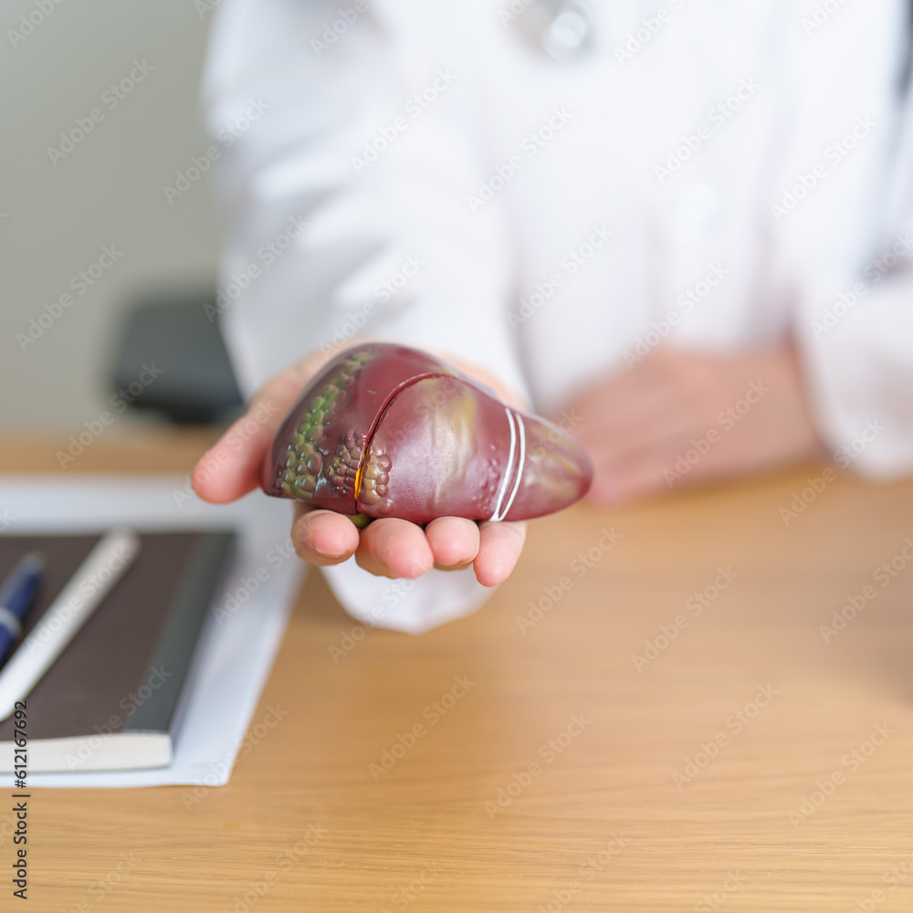 Doctor with human Liver anatomy model. Liver cancer and Tumor, Jaundice ...