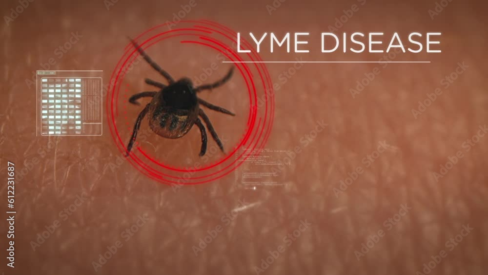 Tick on human skin is scanned for LYME infection. Digital HUD overlay ...