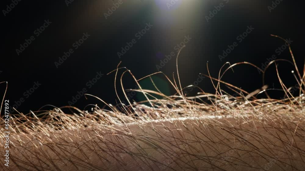 Hand skin texture hair goosebumps close-up. Hairy goose bumps Arm ...