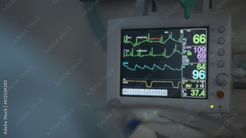 Screen of a monitor showing vital signs of a patient in the operating ...