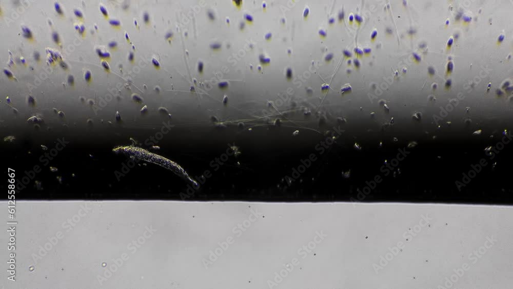 Colony of infusoria and worm are moving magnified under microscope and ...