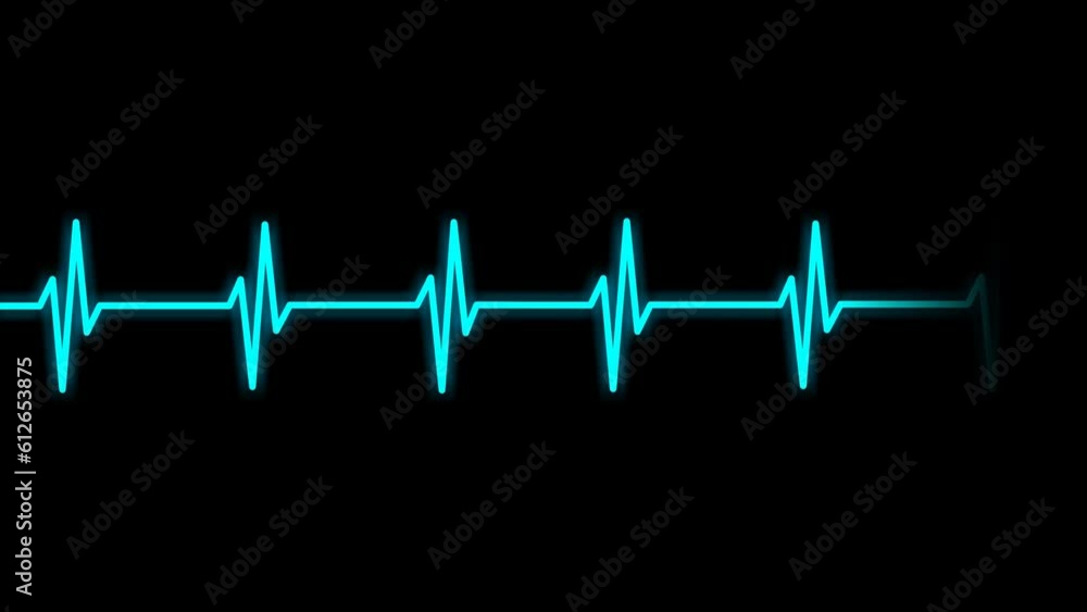Animated EKG heart beat, heart rate EKG monitor display animation Stock ...