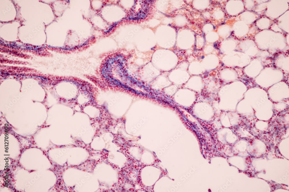 Human lung pathology under light microscope, The lungs is organs of the ...