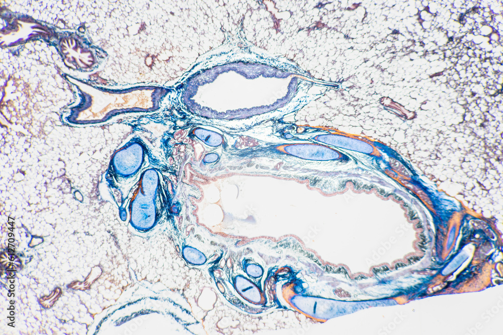 Human lung pathology under light microscope, The lungs is organs of the ...