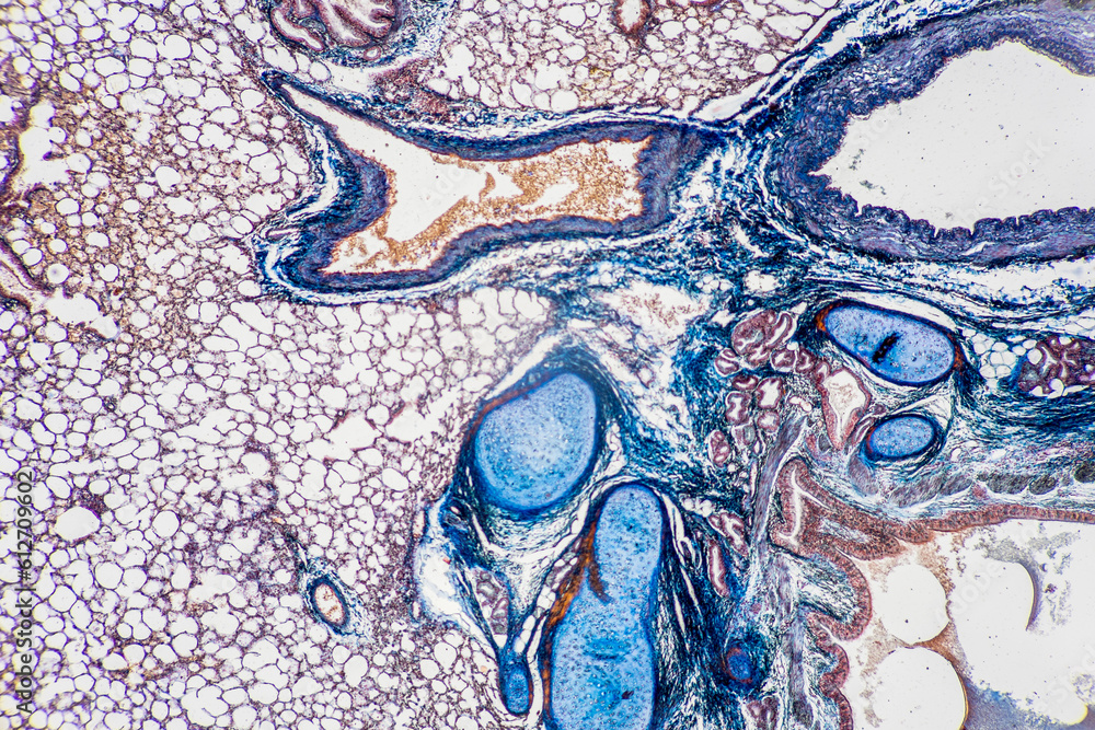 Human lung pathology under light microscope, The lungs is organs of the ...