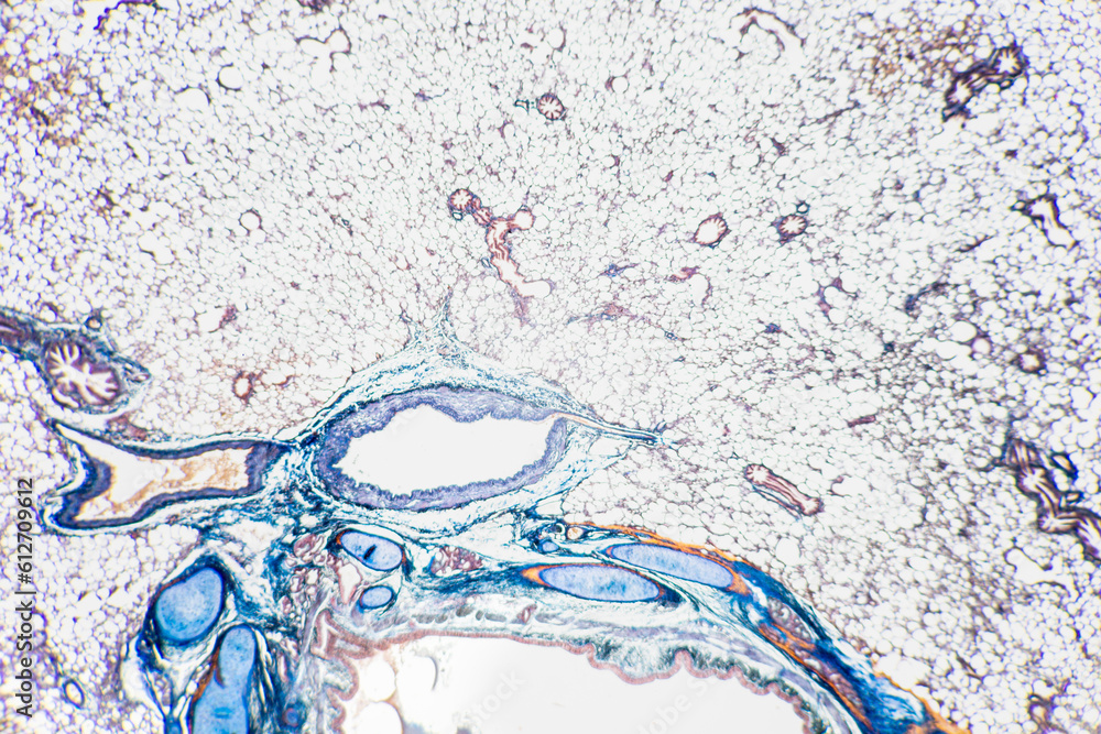 Human lung pathology under light microscope, The lungs is organs of the ...