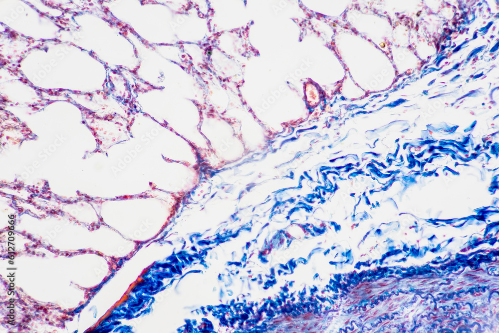Human lung pathology under light microscope, The lungs is organs of the ...