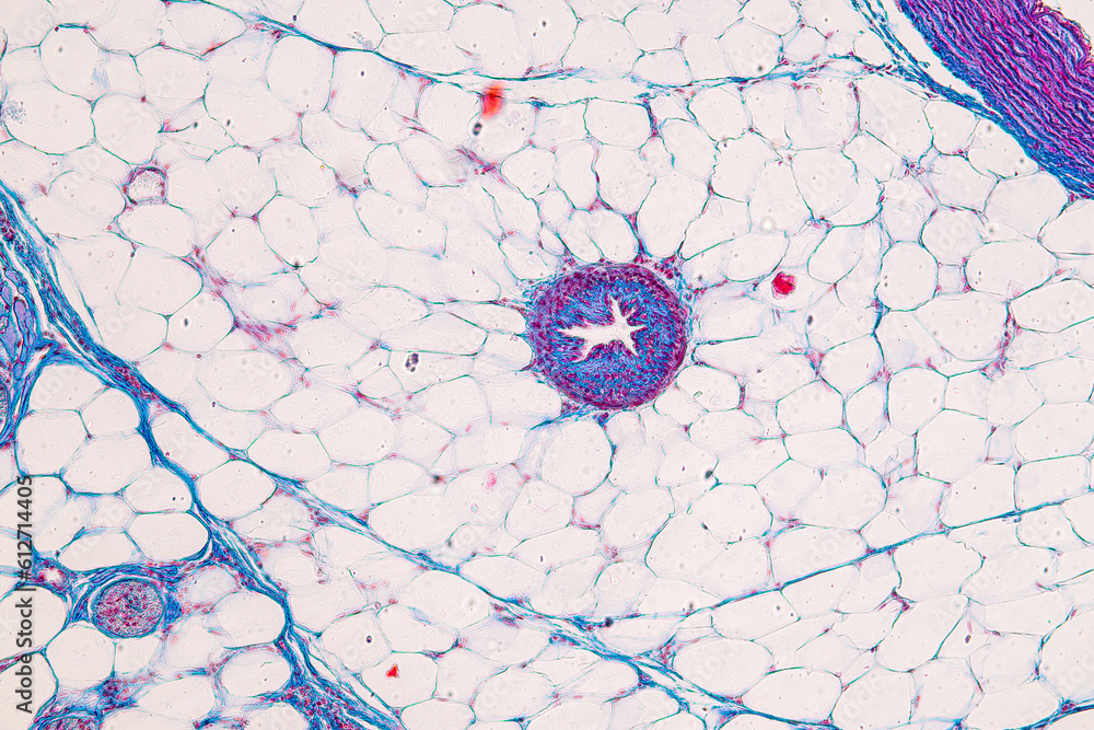 Tissue of Vein, Artery and Aorta Human under the microscope in Lab ...