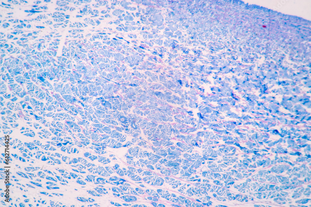 Tissue of Vein, Artery and Aorta Human under the microscope in Lab ...