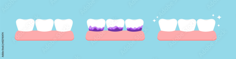 White tooth and with yellow tartar plaque before after plaque test icon ...