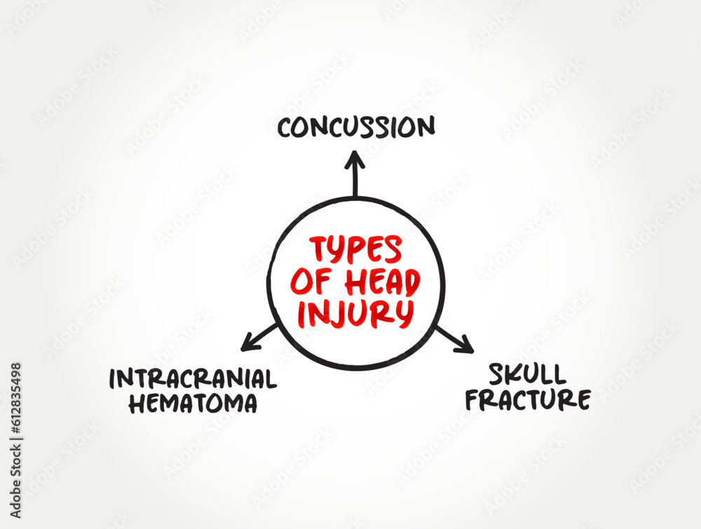 Different types of head injury, mind map text concept for presentations ...
