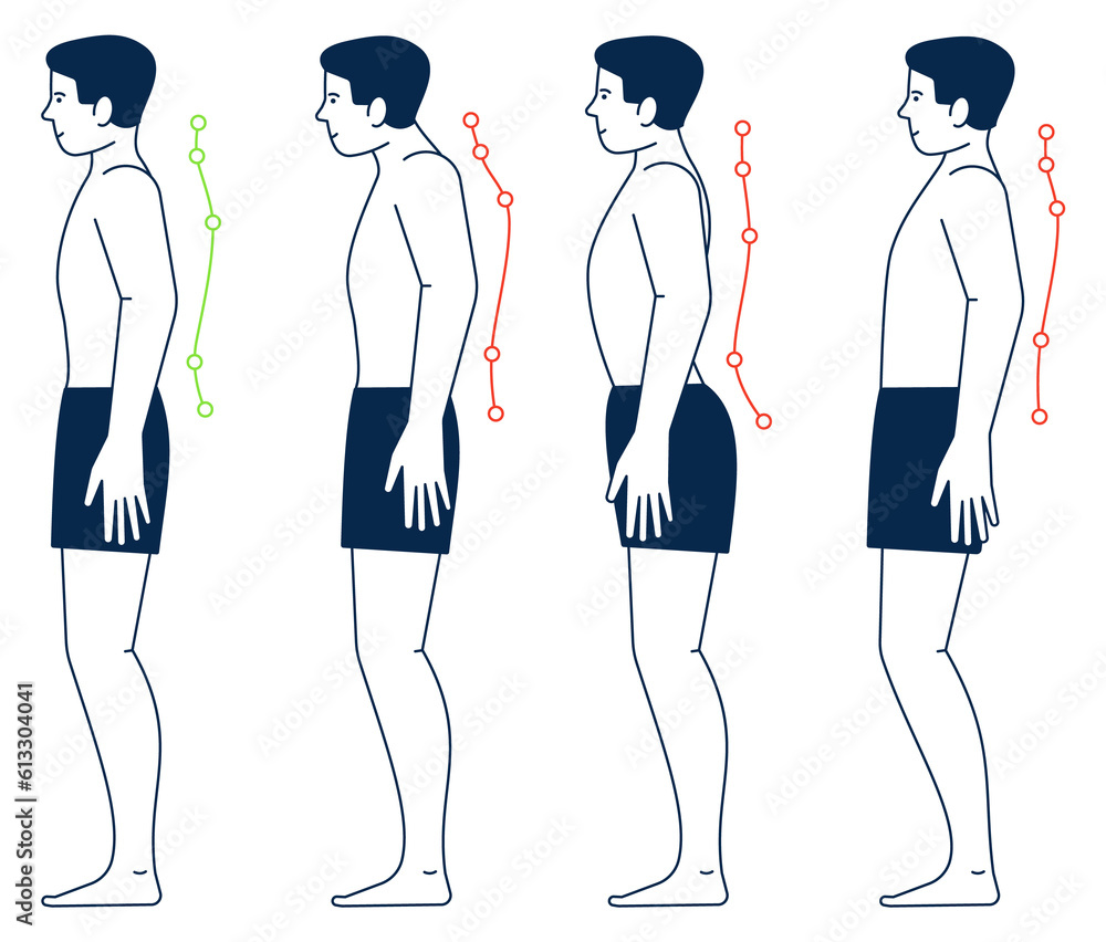 Male body with right and wrong spine postures. Body positions Stock ...
