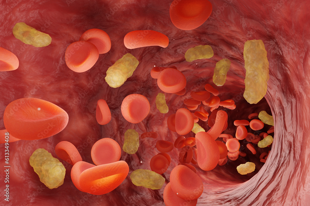 Red blood cells and yellow bacteria flowing in blood vessel ...