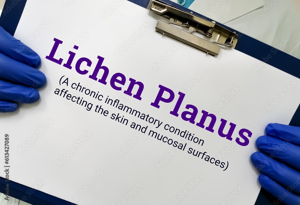 Medical conceptual image. LICHEN PLANUS, is a T-cell mediated ...