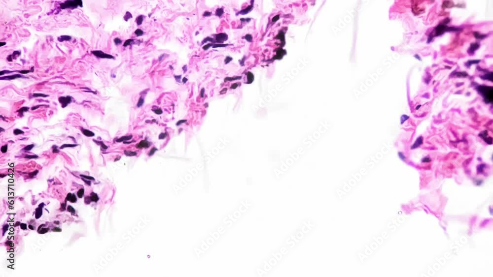 Sample of artery of human being in longitudinal section under ...