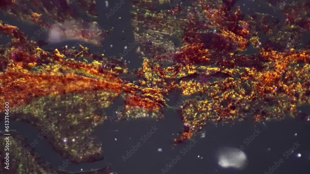 Human transitional epithelium in section under microscope 100x on ...