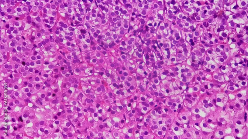 Human adrenal gland under microscope 400x against bright field ...