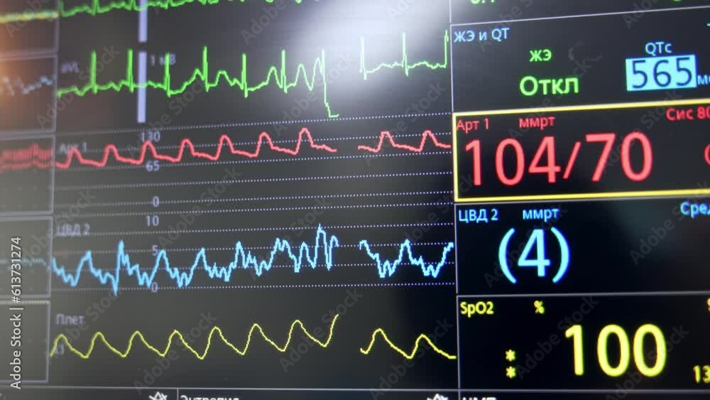 Diverse color curve lines of heart rate, oxygen levels and parameters ...