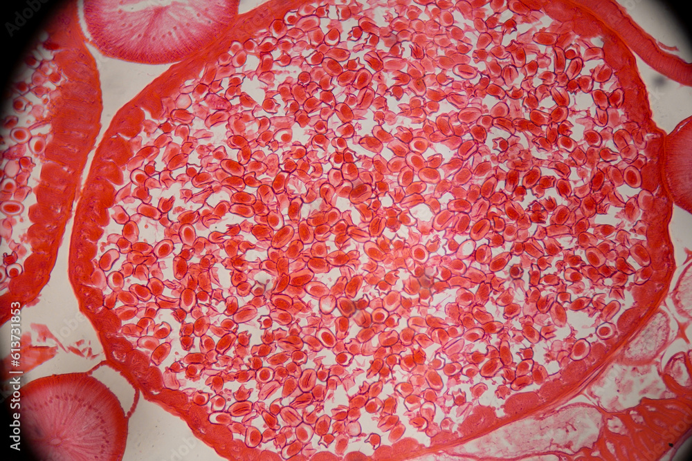 photo of human parasite worms under the microscope Stock Photo | Adobe ...