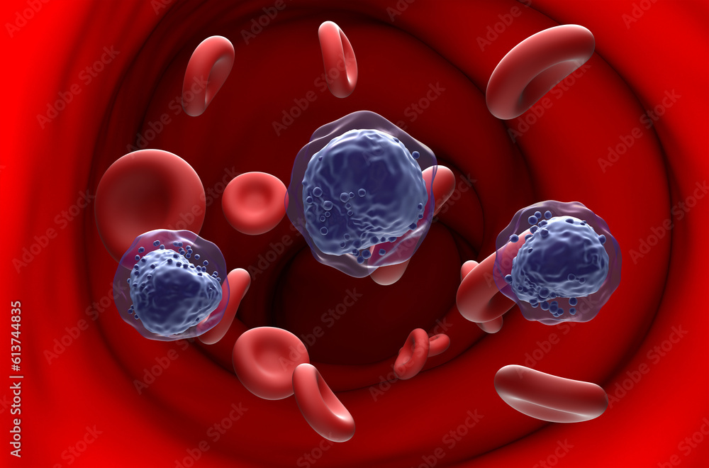 Acute myeloid leukemia (AML) cells in blood flow - section view 3d ...