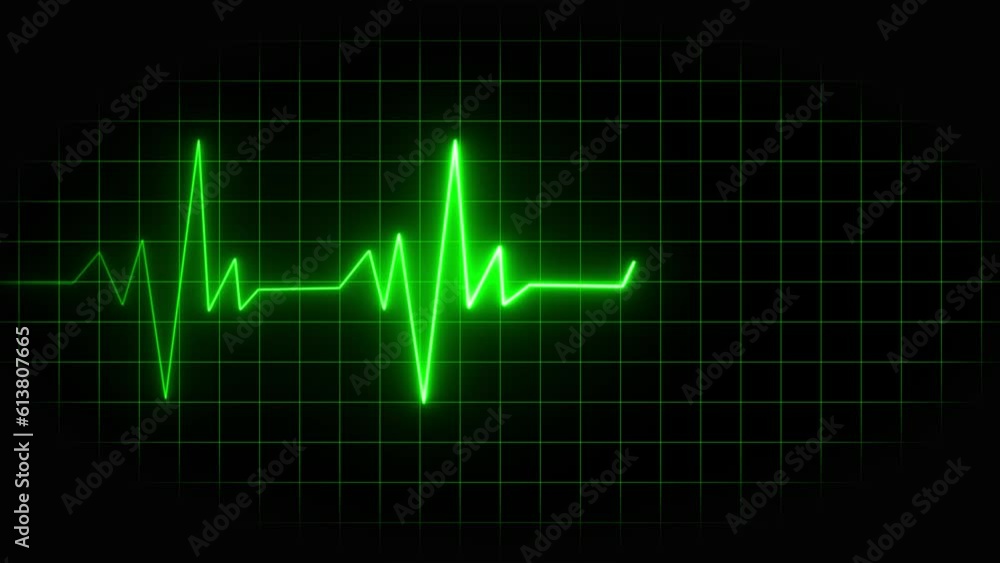 Heartbeat Monitor EKG Cardiogram Loopable. Heartbeat green color line ...