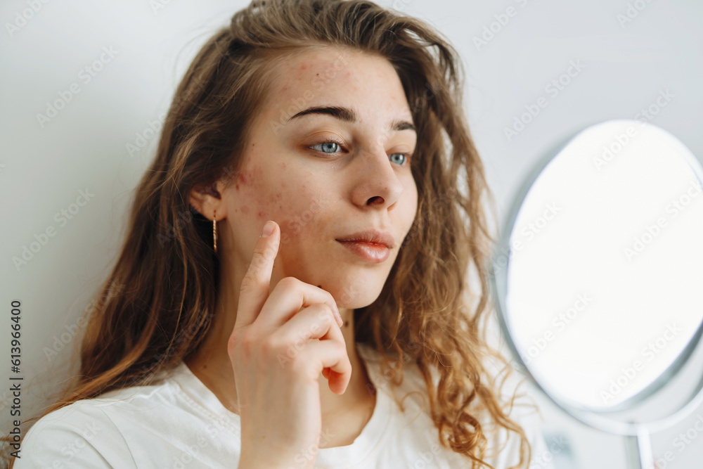 oung woman with problem skin looking into mirror. Dermatology. Allergic ...
