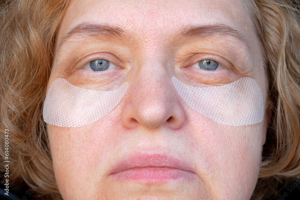 middle aged female's eye with drooping eyelid with patch for eyes ...