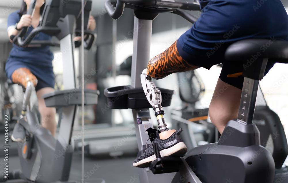 Asian woman with prosthetic leg cycling in gym. Young girl with foot ...