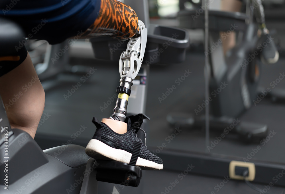 Asian woman with prosthetic leg cycling in gym. Young girl with foot ...