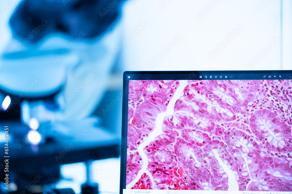 Modern microscope and human tissue section slide with computer monitor ...