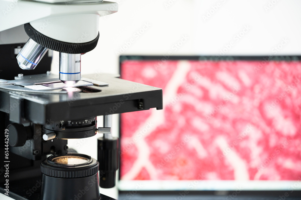 Modern microscope and human tissue section slide with computer monitor ...