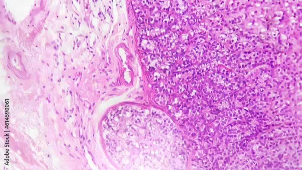 Vidéo Stock Adrenal gland of human being in section filmed under ...