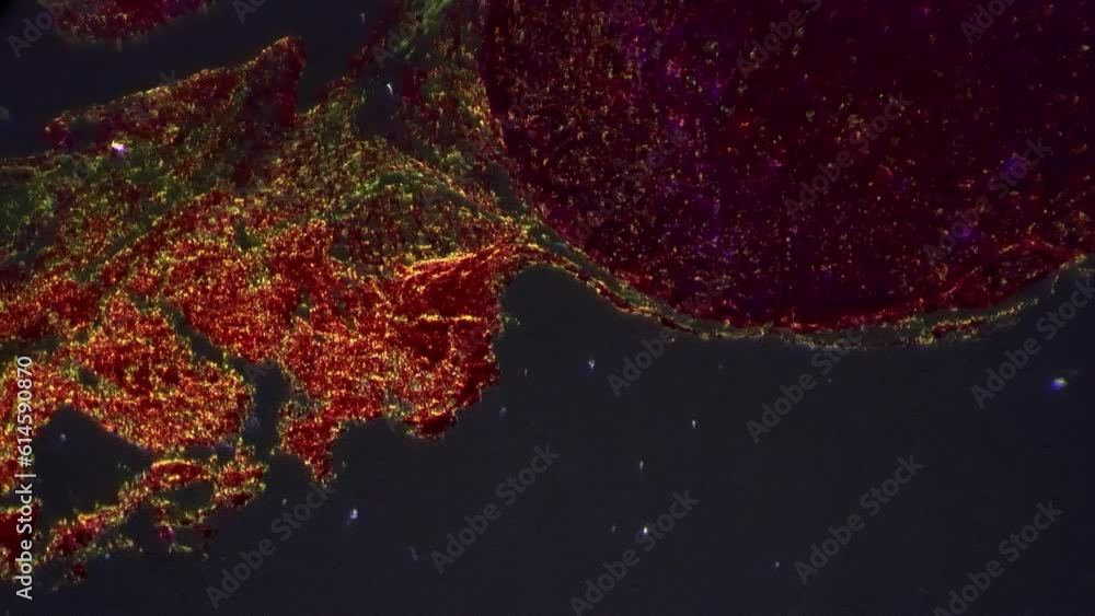 Adrenal gland in section filmed under microscope with 100 times ...