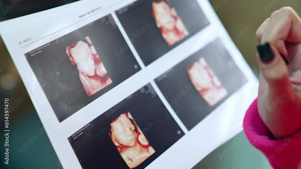 Female hand is touching the images of a baby on the ultrasound scans ...