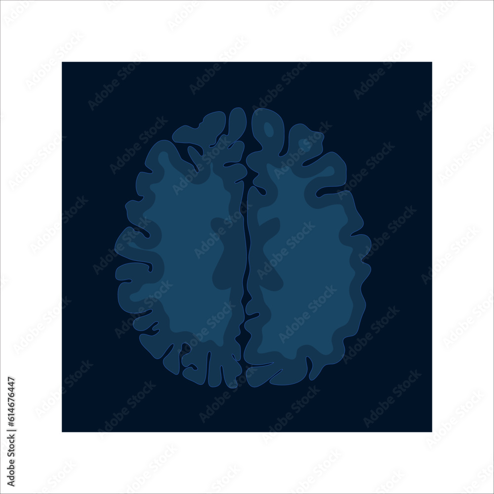 MRI brain scan icon. Medical imaging technology for mental health ...
