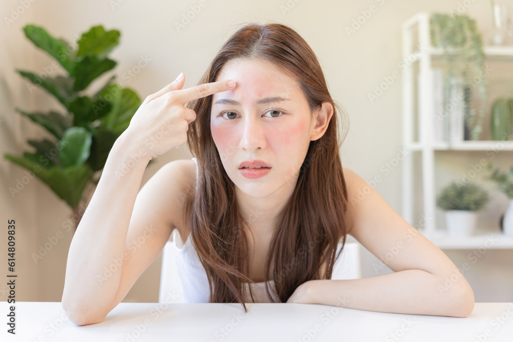 Young woman asian are worried about faces Dermatology and allergic to ...