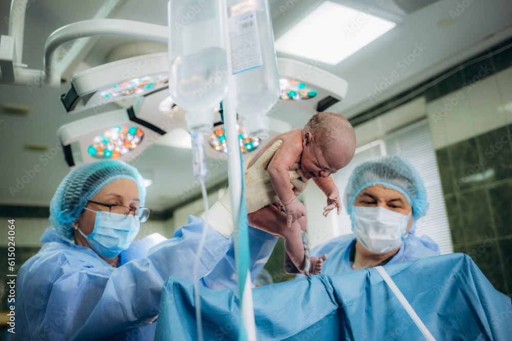 The medical team performing cesarean sections. The doctor hold the baby ...